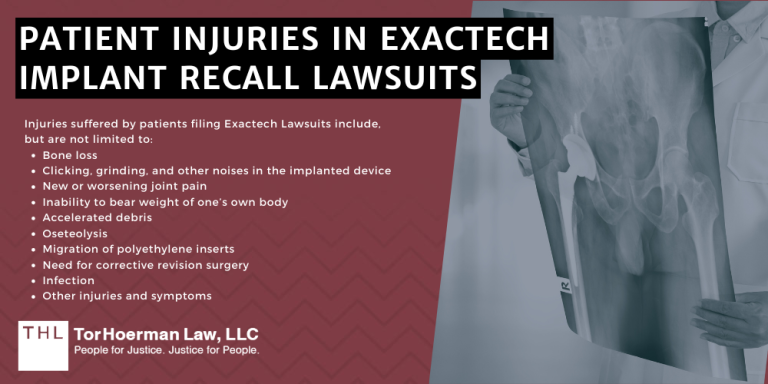 Exactech Implant Recall Lawsuit [September 2025 Update]