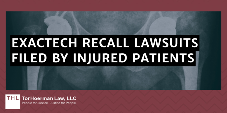 Exactech Implant Recall Lawsuit [September 2025 Update]