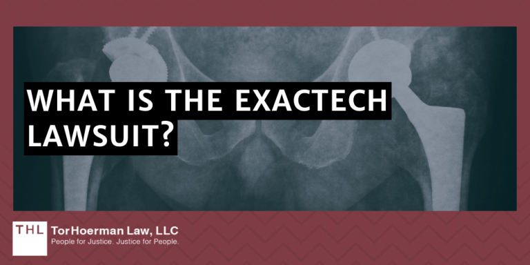 Exactech Lawsuit [2025 Update] | Exactech Recall Lawsuits