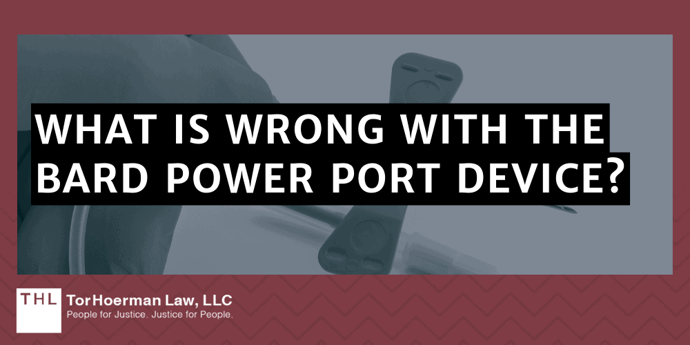 FAQ: What Are The Problems With Bard Power Port Devices?