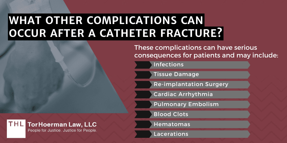 [2023 Update] Bard PowerPort Catheter Fracture Lawsuit