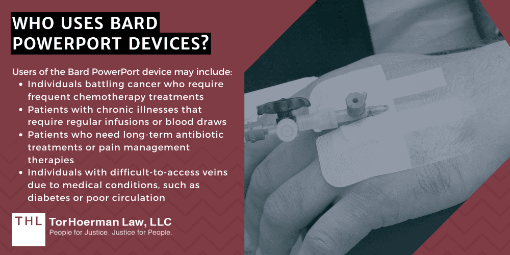 Bard PowerPort Migration Lawsuit | 2024 Update