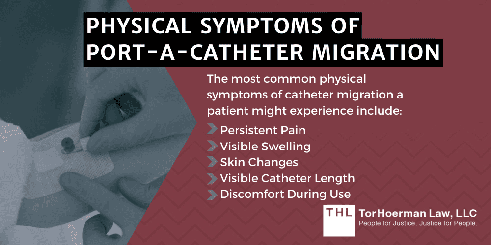 FAQ: What Are Port-a-Catheter Migration Symptoms?