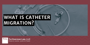 FAQ: What Are Port-a-Catheter Migration Symptoms? | TorHoerman Law