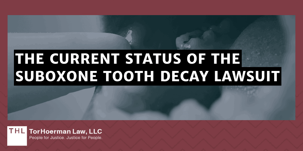 FAQ: Who Qualifies For The Suboxone Dental Lawsuit? [2024]