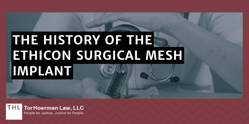 Ethicon Transvaginal Mesh Lawsuit [2024 Update]
