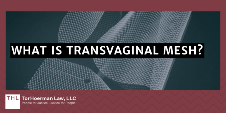 Common Transvaginal Mesh Complications | 2025 Guide