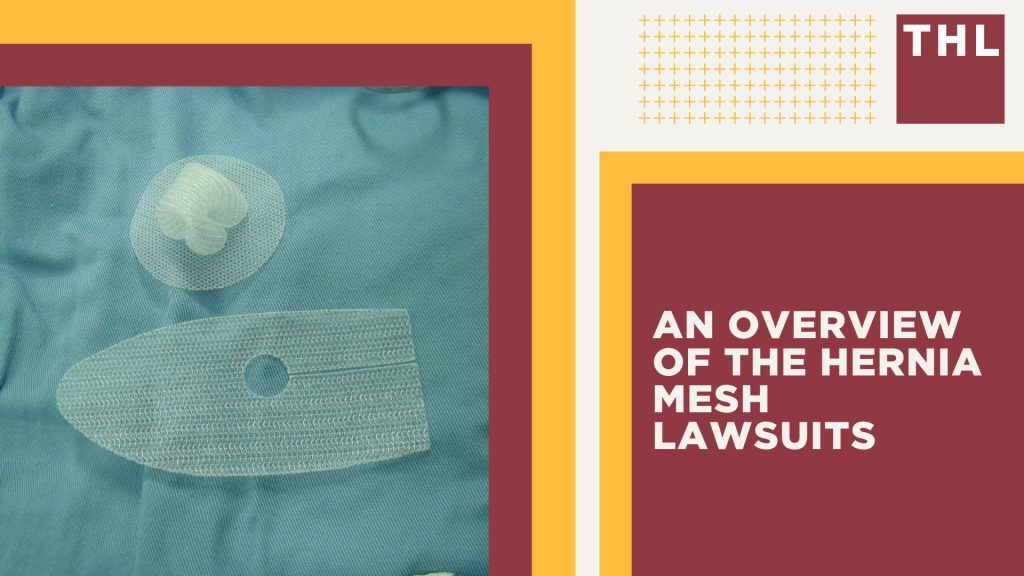 Hernia Mesh Lawsuit Settlement Amounts May 2025