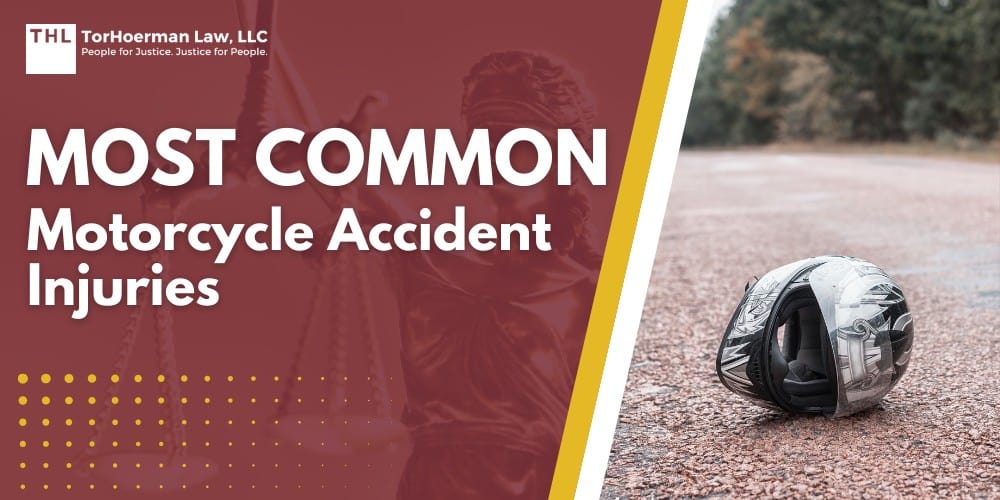 Most Common Motorcycle Accident Injuries | Call Us Today