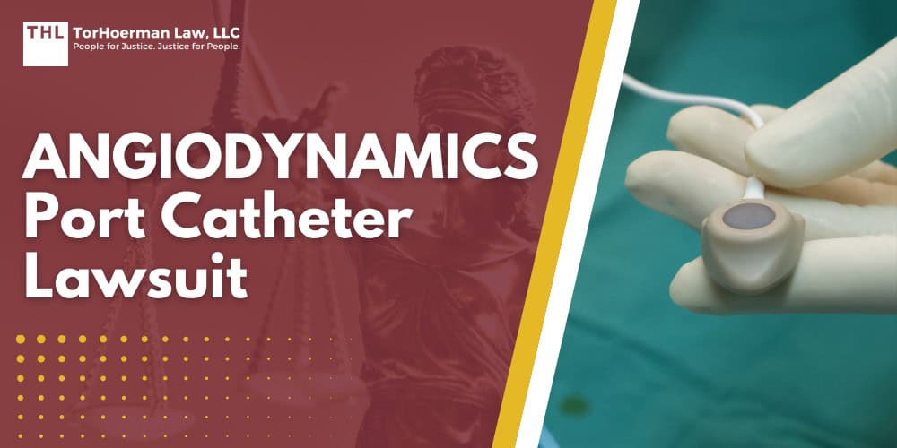 AngioDynamics Port Catheter Lawsuit [October 2025 Update]